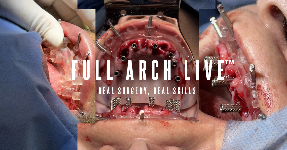 Prices Packages and Dates – Full Arch Live